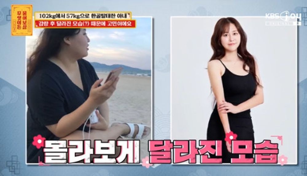 102kg→57kg 감량 후 성형욕심 아내...서장훈 "성형 말고 운동" 팩폭 (‘무물보’)[종합]