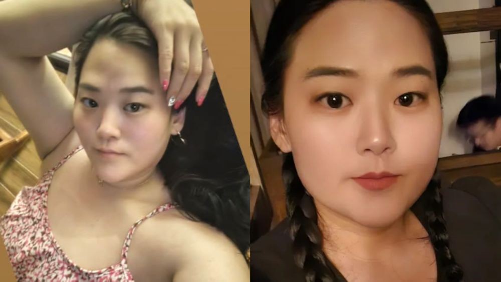 '미나 시누이' 수지, 72kg 감량 후 한국 떠났다…"몰라보게 달라졌네" [RE:스타]